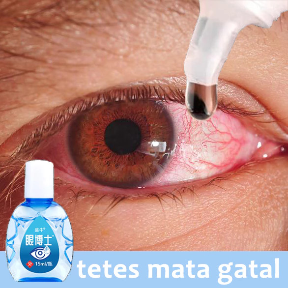 Jual Obat Tetes Mata Obat Mata Katarak Mata Kering Sakit Mata Darah ...