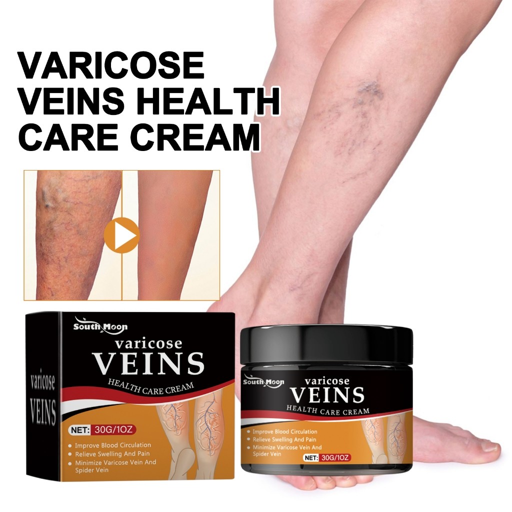 Jual South Moon Krim varises meredakan nyeri dan bengkak, memperbaiki ...