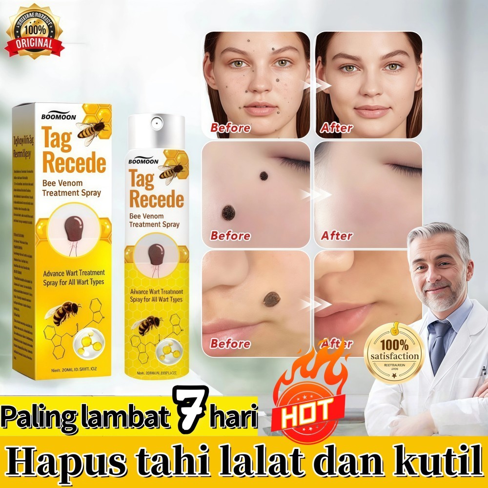 Jual Penghilang tahi lalat di wajah Penghilang kutil di leher Wart ...