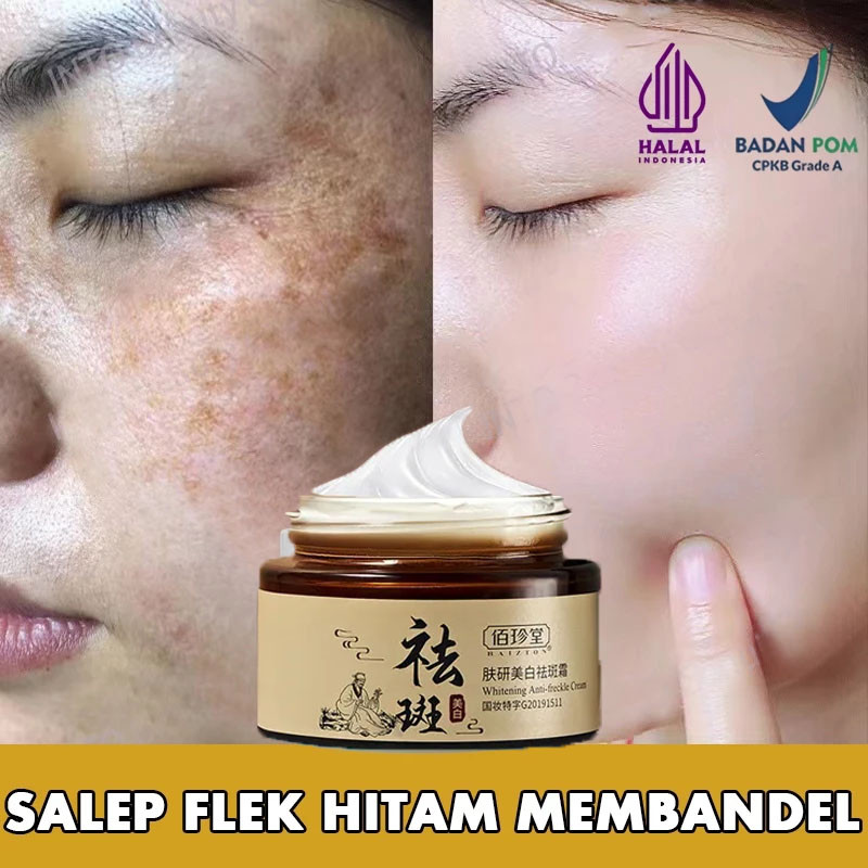 Jual Krim penghilang flek hitam cream flek hitam membandel salep flek hitam membandel 30g ...