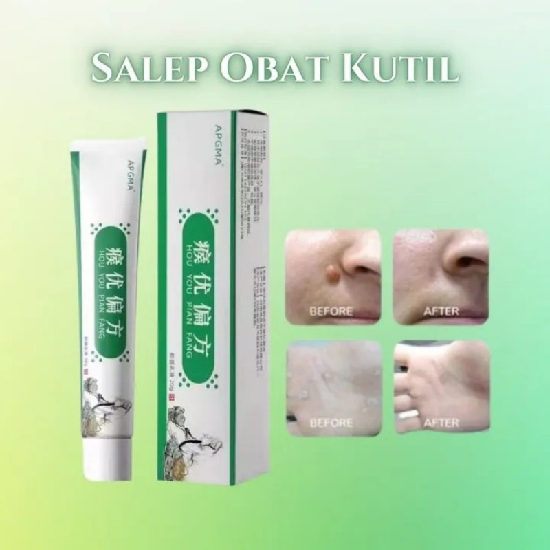 Jual Penghilang tahi lalat obat penghilang kutil skin tag Paling Ampuh ...