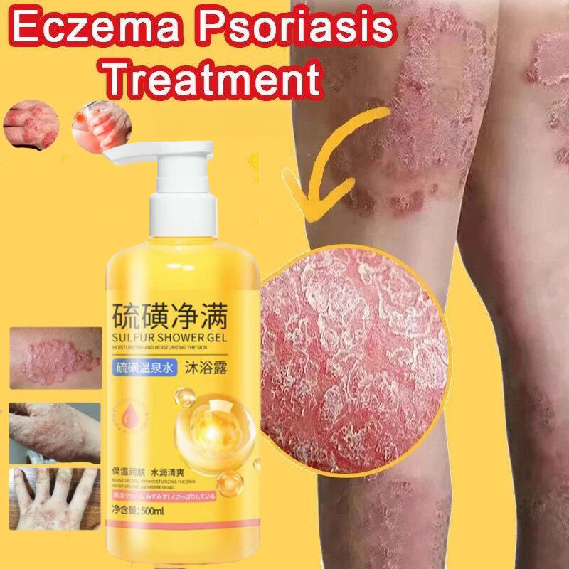 Jual 500ML Eczema Body Wash Sabun Eksim Sabun Gatal Kulit Ampuh Sabun ...