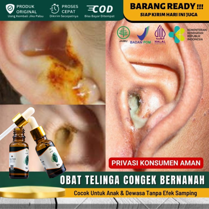 Jual Otesli Obat Tetes Telinga 20 ml Untuk atasi Telinga Budeg ...