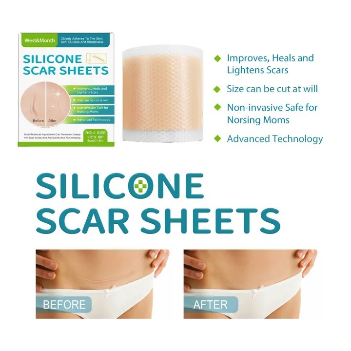 Jual Self-Adhesive Silicone Scar Sheet Keloid Remover Scar Covering ...