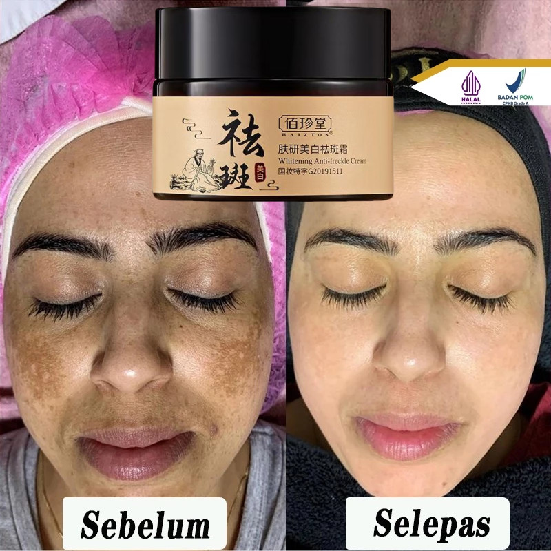 Jual Krim penghilang flek hitam cream flek hitam membandel salep flek hitam membandel 30g ...