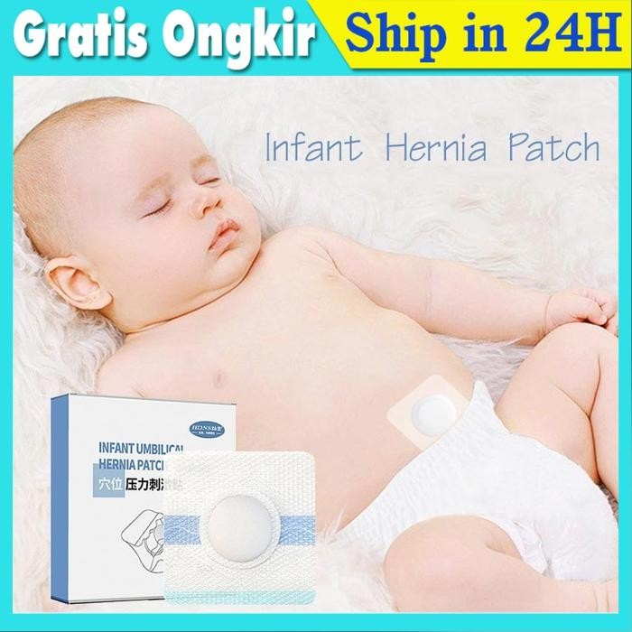 Jual Umbilical Infant Bodong Hernia Patch Pusar Bodong Bayi Sachet ...