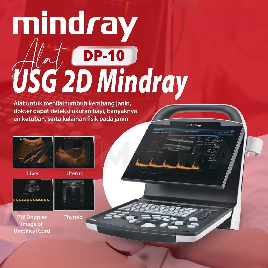 Jual [SUNNYPAWS] MINDRAY Alat USG 2D DP-10 with Doppler & Probe ...