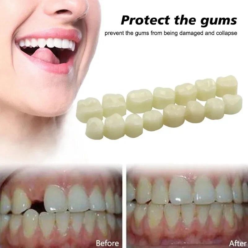 Jual 70/50pcs Dental Teeth Veneers Whitening False Denture Resin ...