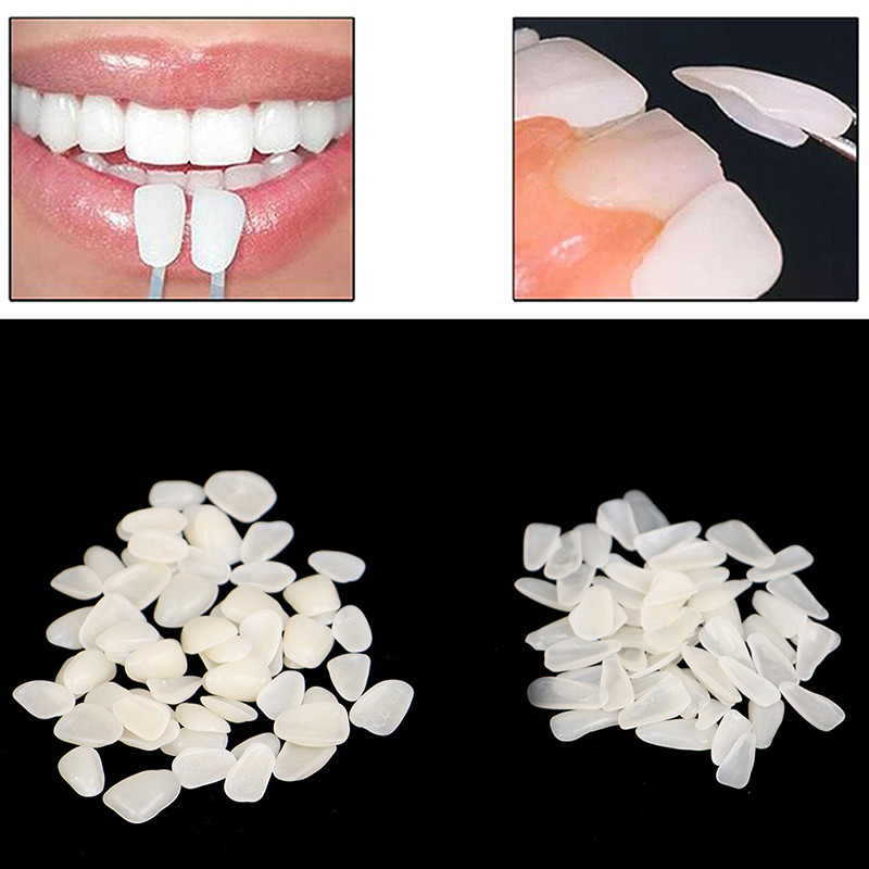Jual 60PC Dental Ultra-Thin Whitening Veneers Resin Porcelain Materials ...