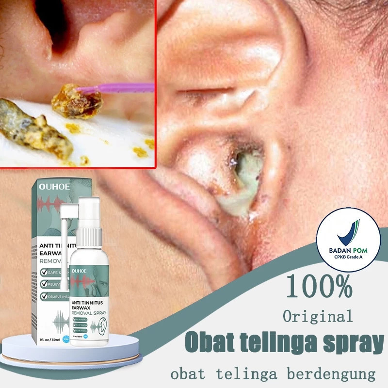 Jual Obat Tetes Telinga Congek Bernanah Bau Busuk Curek Telinga Gatal ...