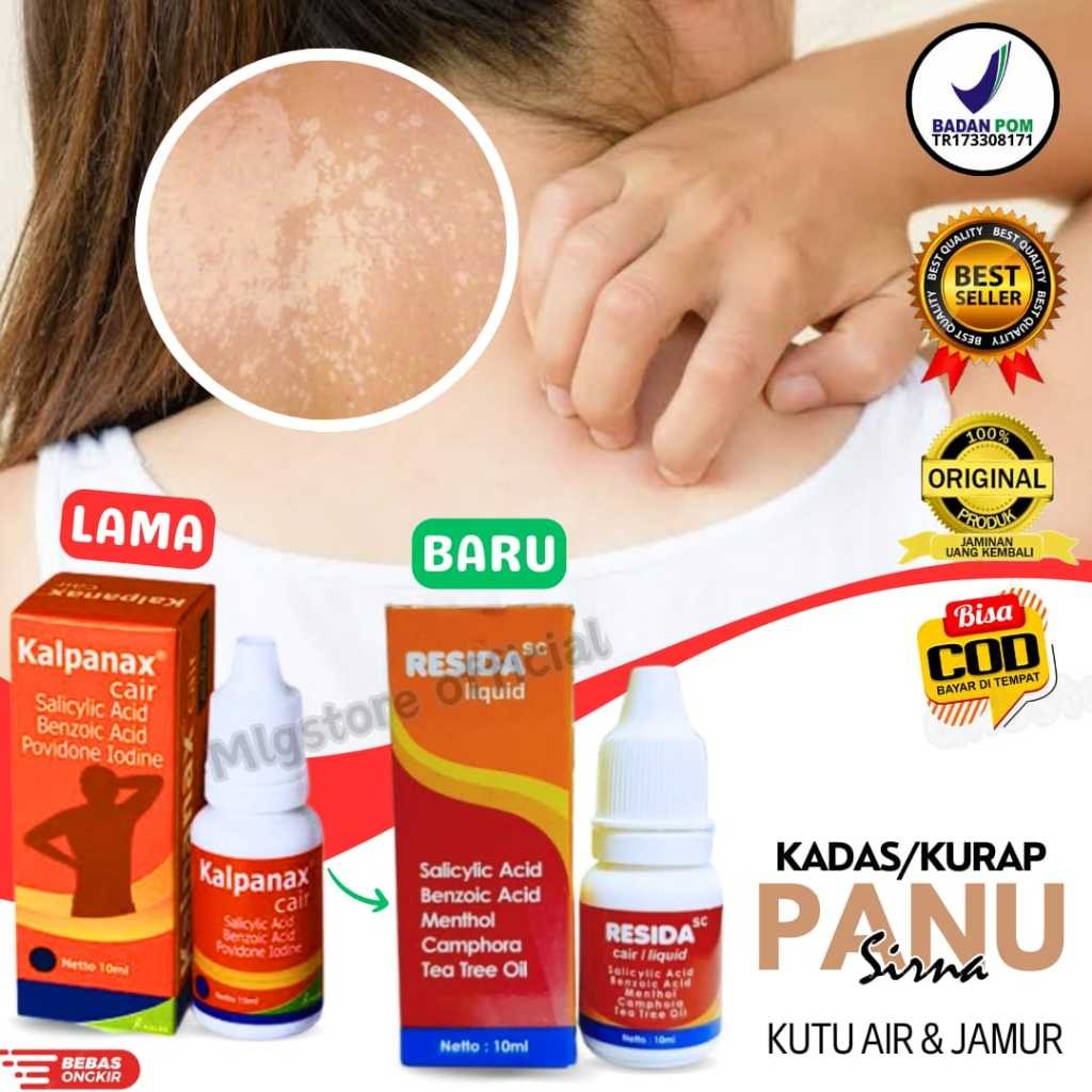 Jual Resida Cair Obat Panu Ampuh 100% / Salep Cream Obat Kadas Kurap ...