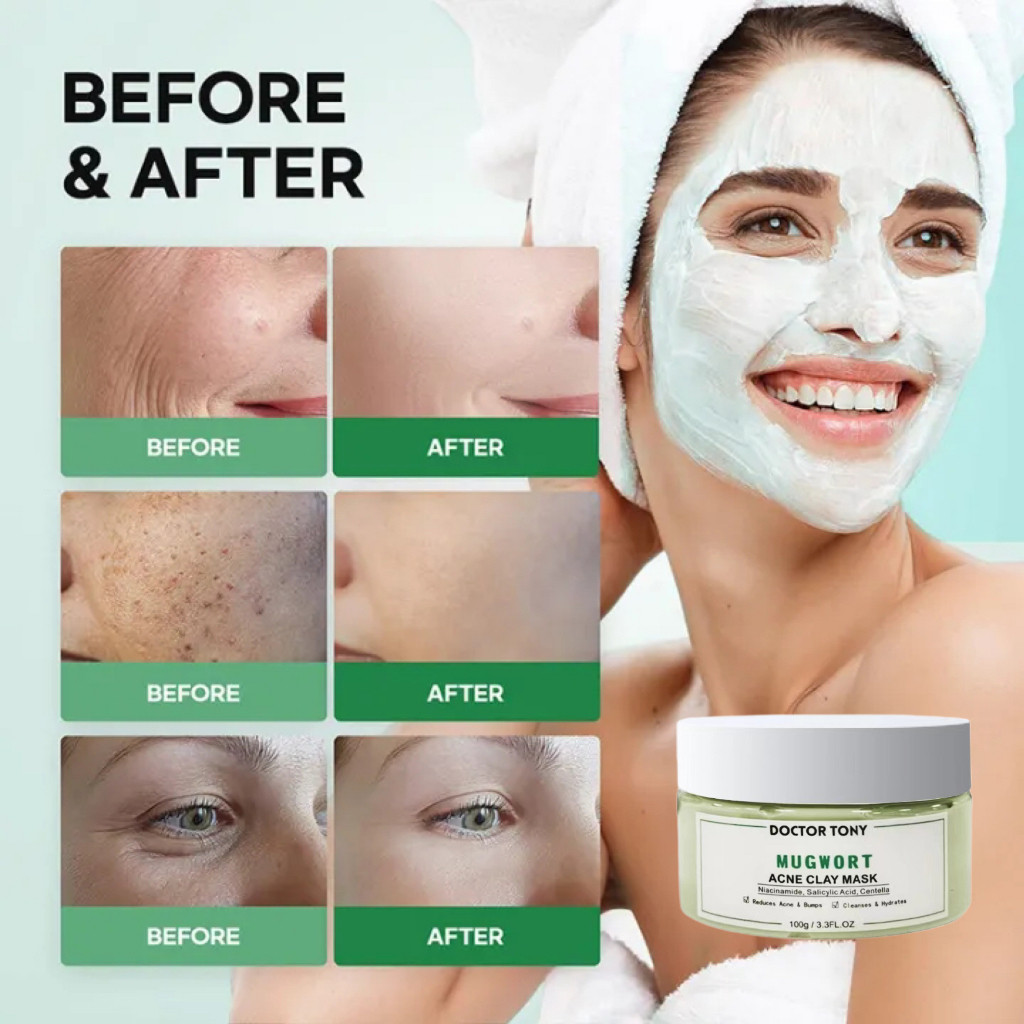 Jual SKINTIFIC Mugwort Mask Anti Pores & Acne Clay Mask Pore Clarifying ...