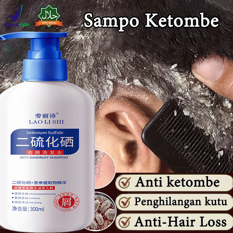 Jual Laolishi Selenium Disulfide Shampoo Oil Control Anti-Dandruff Anti-Itch Clear Malassezia ...