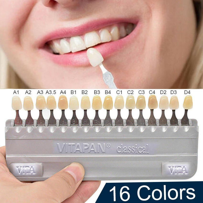 Jual Vita Vitapan Classical Dental Shade Guide \ Pengukur Wanna Gigi ...