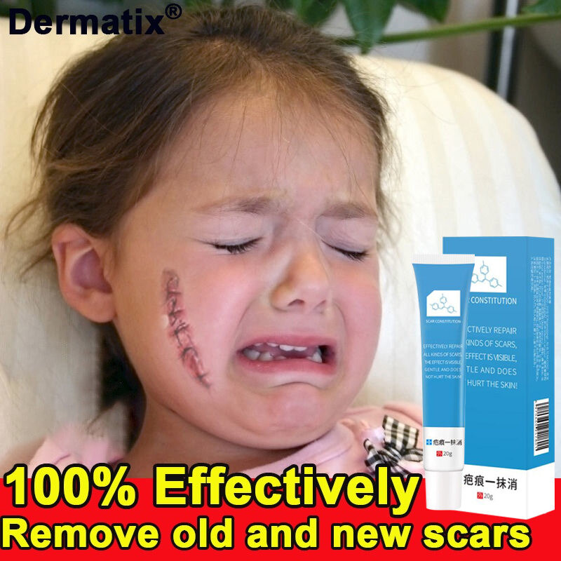 Jual 100% Authentic scar remover cream Repairs Scars on the Body, Fades ...