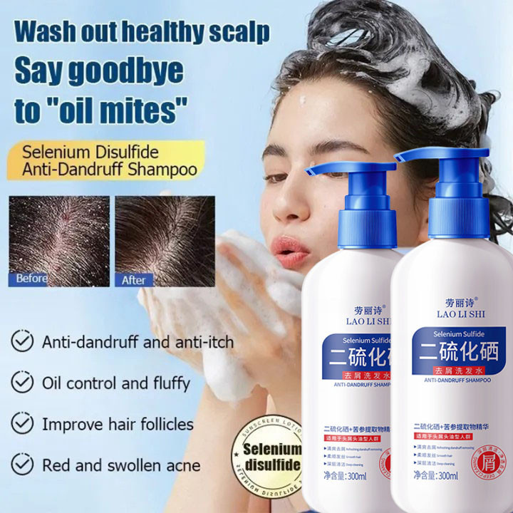 Jual (COD) Selenium Disulfide Shampoo Oil Control Anti-Dandruff Anti ...