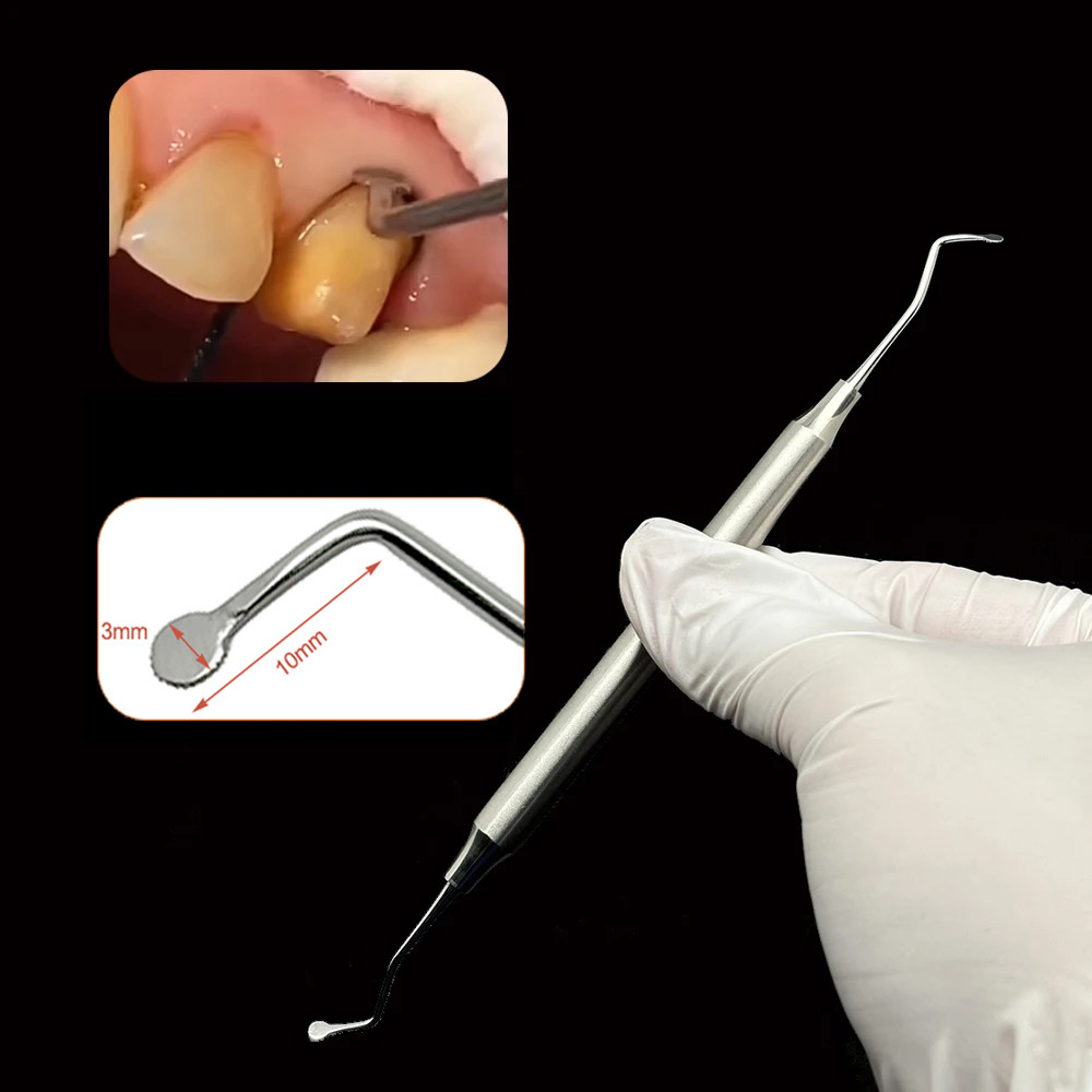 Jual Dental Gingival Retraction Cord Packer Stainless Steel Gingival ...