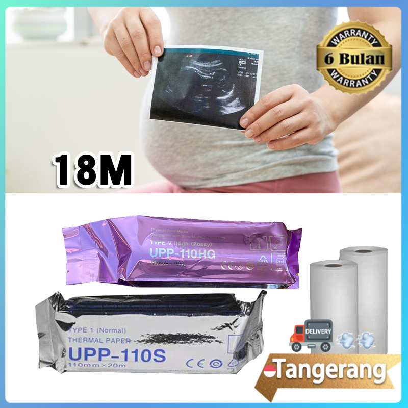 Jual Kertas USG Sony UPP 110HG / Printer USG / UPP 110S Printer USG ...