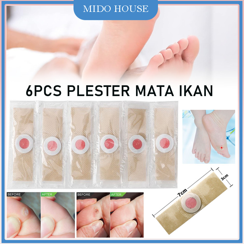 Jual 3X6Pcs Plester Mata Ikan/ Mata Ikan Foot Corn Removal Plester ...