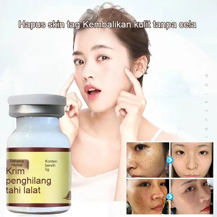 Jual Concentrated Potent Skin Tag Removal Cream Body Warts Cream ...