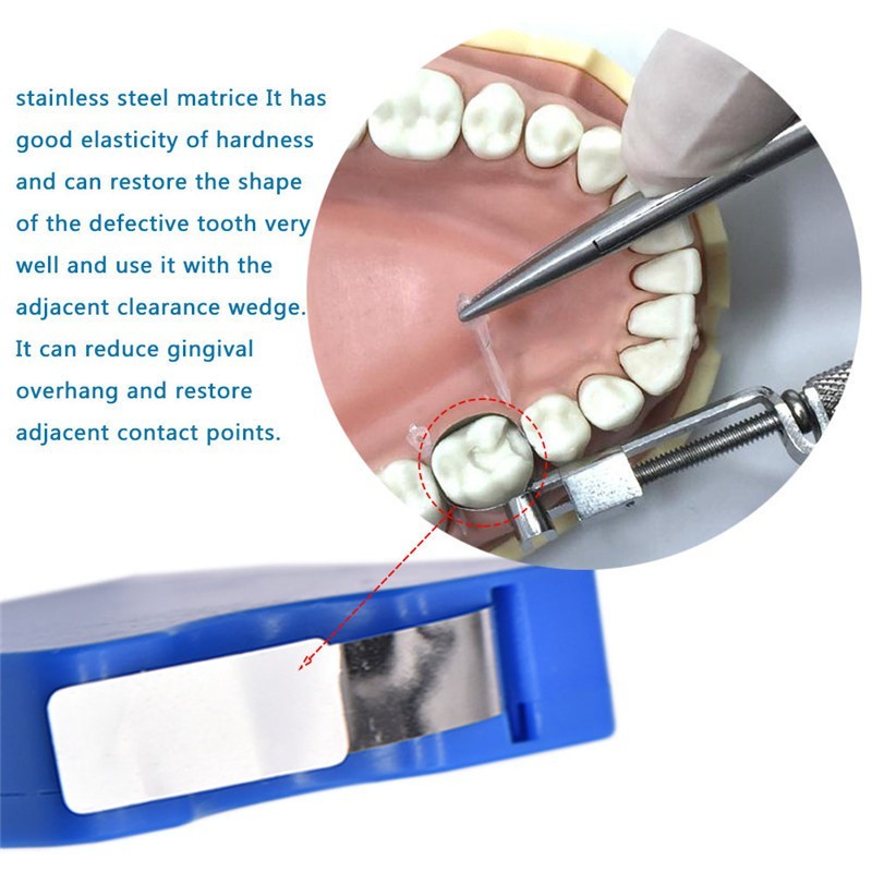 Jual Dental Matrix Band / Mylar Seluloid Celluloid Strip / Dental ...