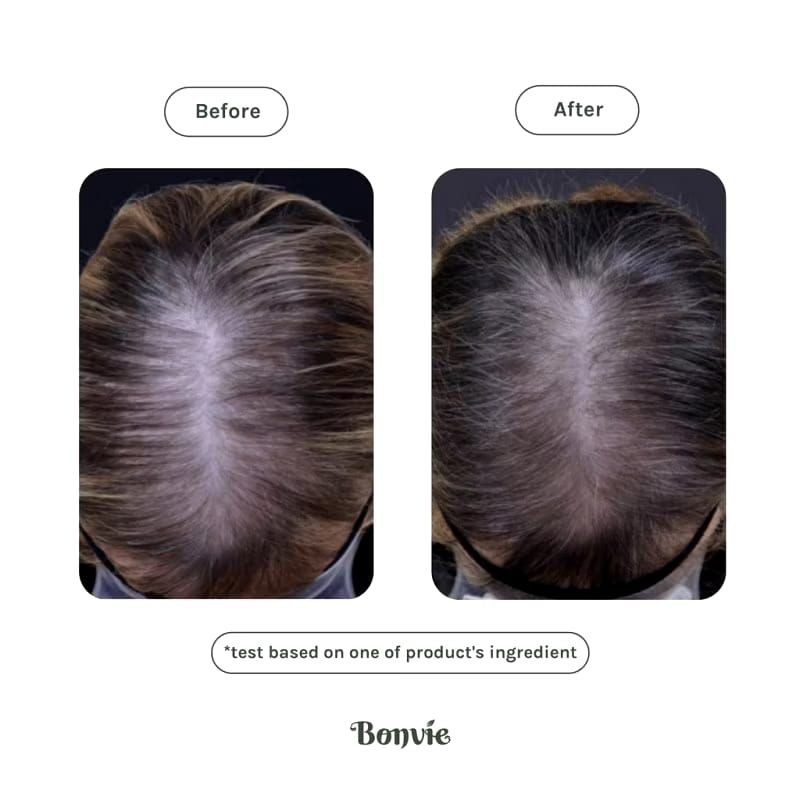 Jual Bonvie Hair Tonic Anti Hairfall Kemiri Gin Hair Tonic (60ml) with ...