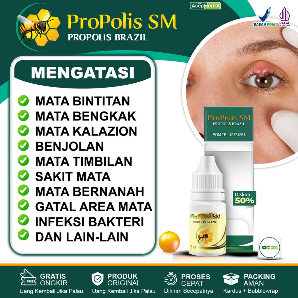 Jual Obat Mata Bintitan Kalazion Pada Anak Dan Dewasa Penghilang ...