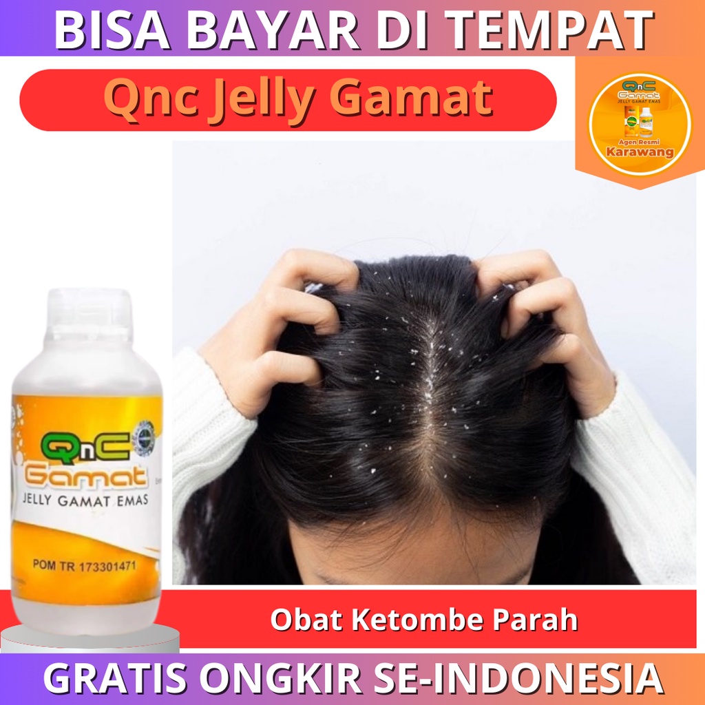 Jual Obat Ketombe Parah, Obat Ketombe dan Gatal, Obat Ketombe, Obat Ketombe Berkerak, Obat ...