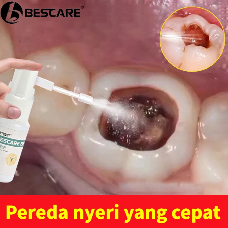 Jual COD obat sakit gigi - obat sakit gigi berlubang ampuh - obat sakit ...