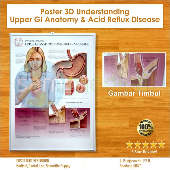 Jual Poster 3D Upper GI anatomy & Acid Reflux Disease BS 122RR | Shopee ...