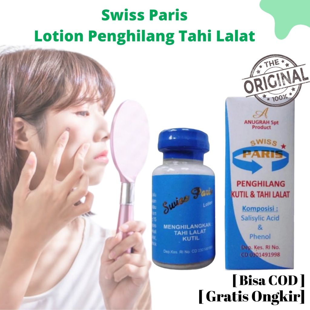 Jual Lotion Swiss Paris Penghilang Tahi Lalat, Kutil, Mata Ikan, Dan ...