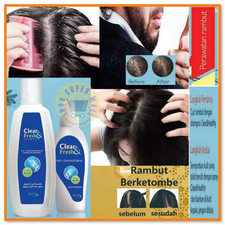 Jual Sampo Anti Ketombe My Way | Spray Anti Dandruff | Krim Anti Ketombe | Clear & Fresh My Way ...