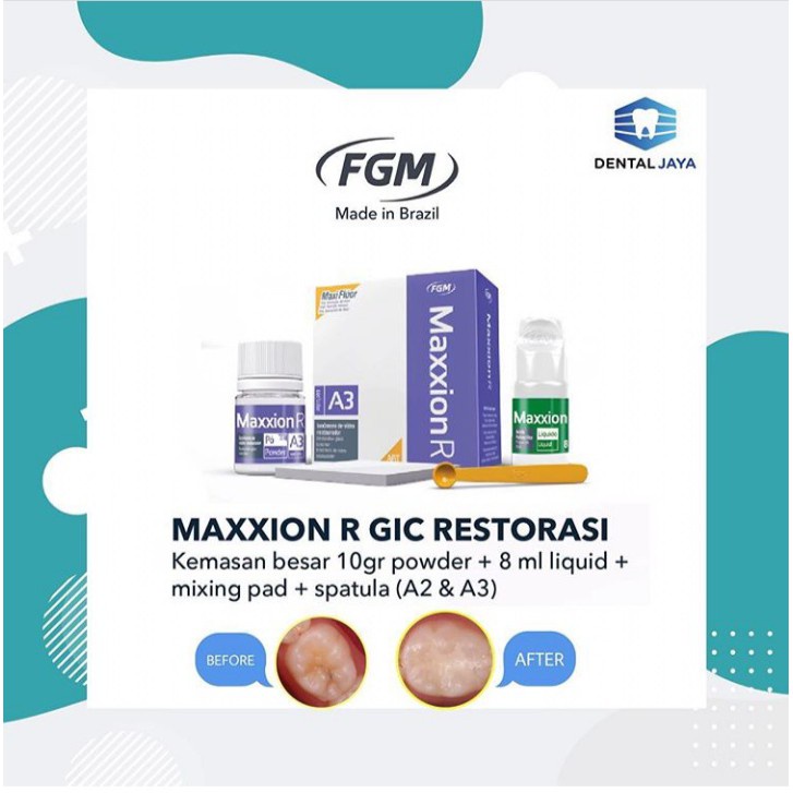 Jual FGM Maxxion R GIC | Fuji Ix | Glassionomer | Semen Ionomer Kaca | Shopee Indonesia