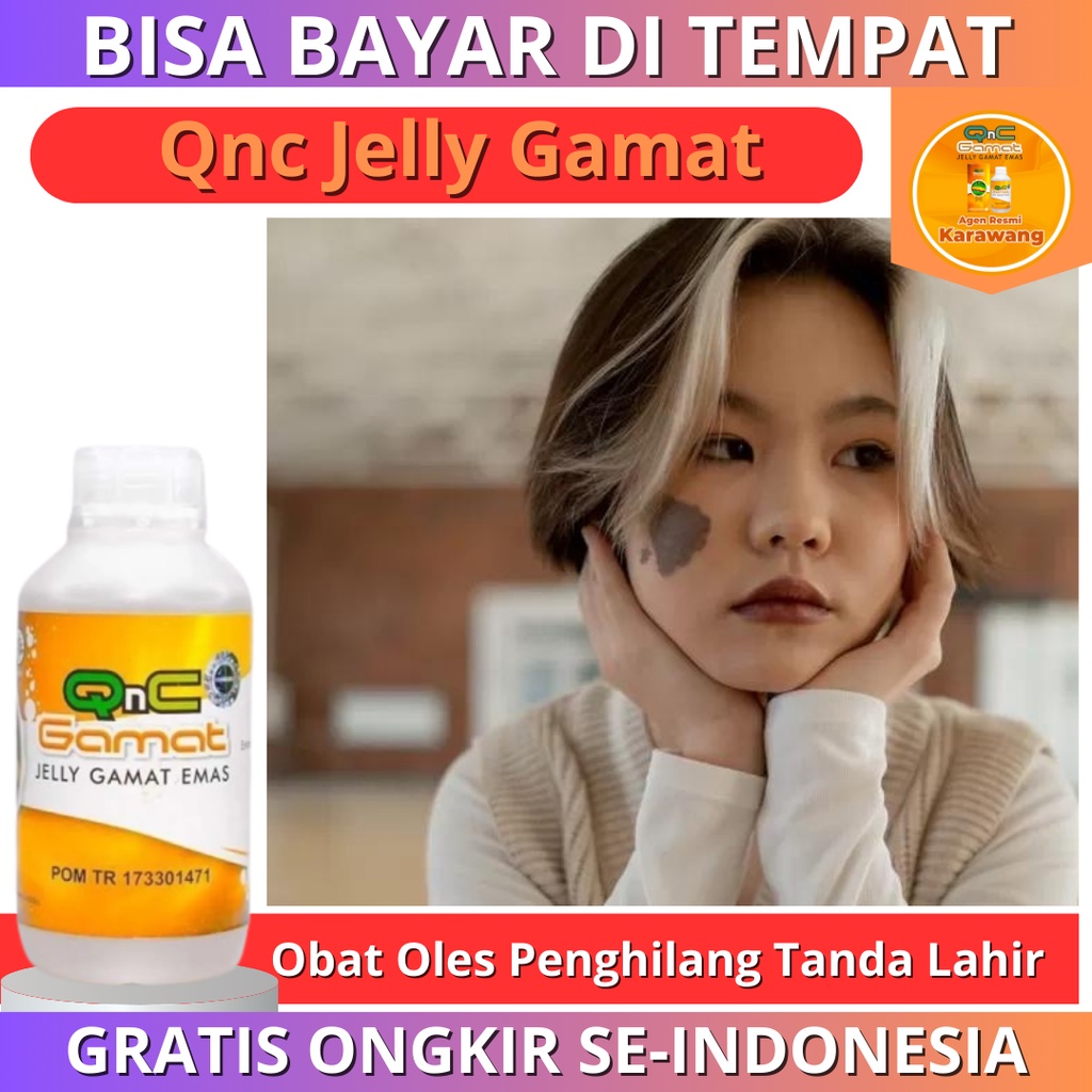 Jual Obat Oles Penghilang Tanda Lahir, Penghilang Hemangioma, Tanda Lahir di Badan, Memudarkan ...