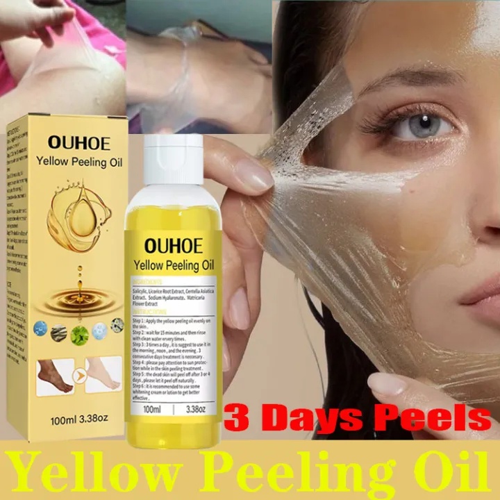 Jual OUHOE Yellow Skin Oil Peeling Oil Dark spot remover Whitening skin ...