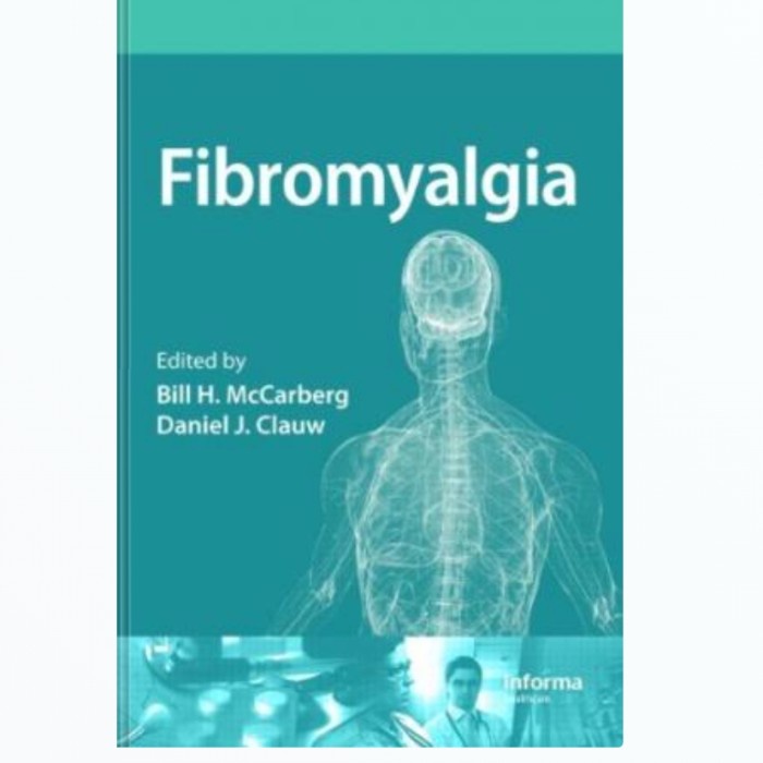 Jual Buku Fibromyalgia by McCarberg Bill | Shopee Indonesia