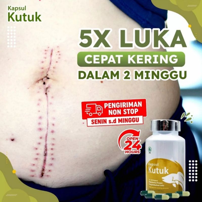 Jual OBAT SIPILIS KAPSUL KUTUK PREMIUM ASLI 100% ORIGINAL OBAT PENGERING LUKA PASCA OPERASI ...