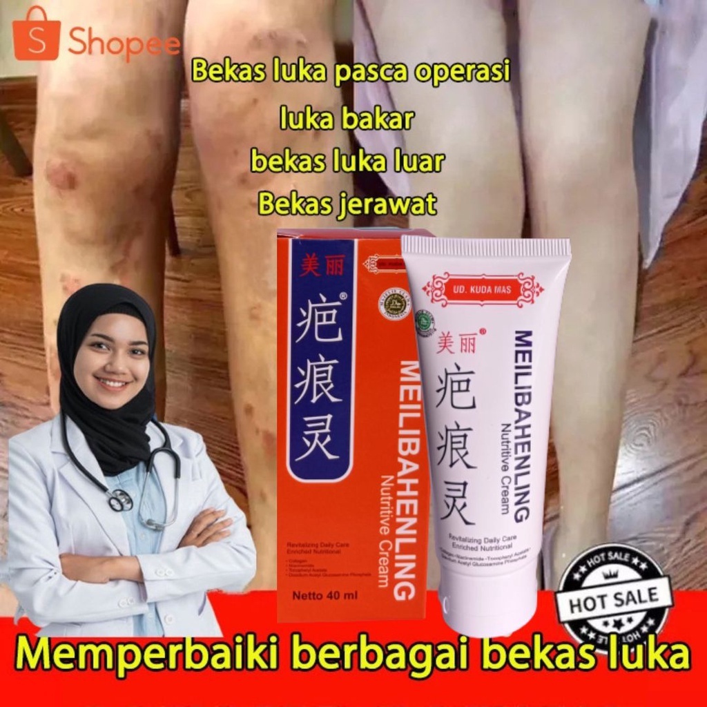 Jual Penghilang Bekas Luka Koreng Cacar Air Kudis Kurap Gigitan Nyamuk ...