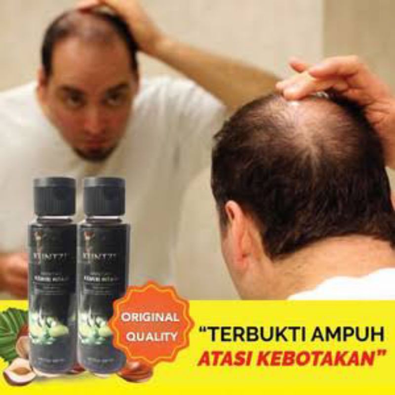 Jual Penumbuh Rambut Botak Penghilang Uban Pelebat Rambut Rontok Obat ...