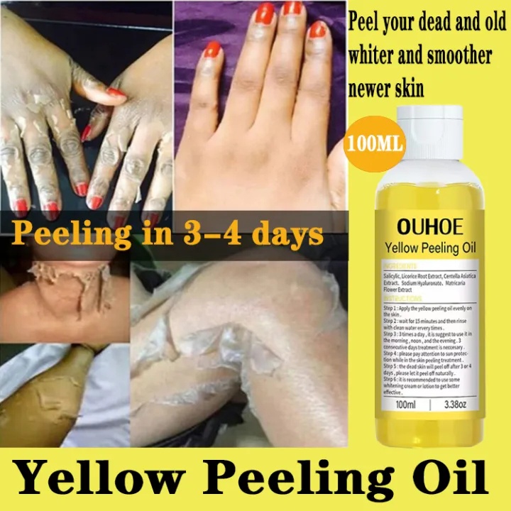 Jual OUHOE Yellow Peeling Oil Skin Oil Dark spot remover Whitening skin ...