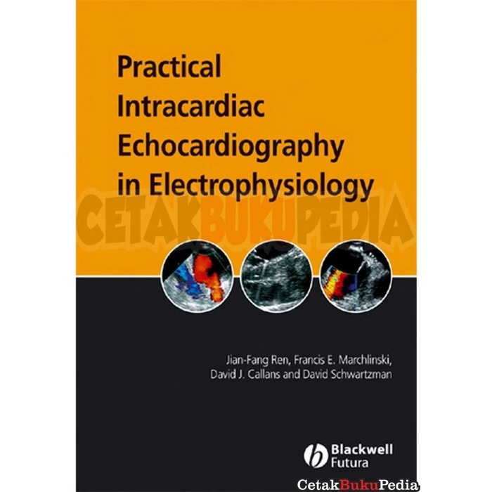 Jual Book Practical Intracardiac Echocardiography in Electrophysiology | Shopee Indonesia