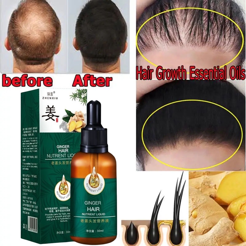 Jual 7 Day Ginger Essence Shampoo/Hair Growth Treatment Ginger Essence ...