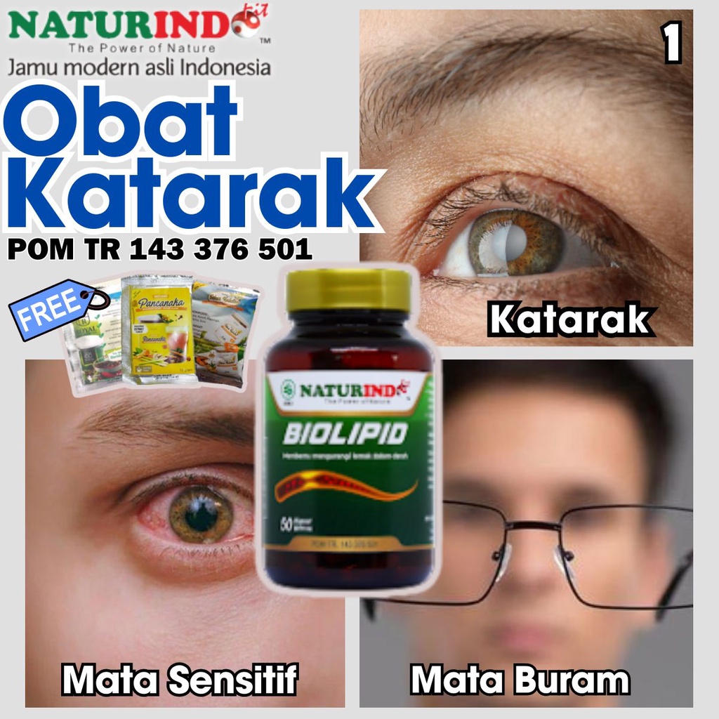 Jual obat mata berlemak biolipid naturindo tanpa operasi mata katarak ...