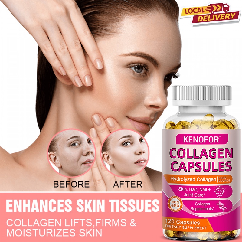 Jual Collagen Supplement - Collagen Supplement To Support Hair, Skin ...