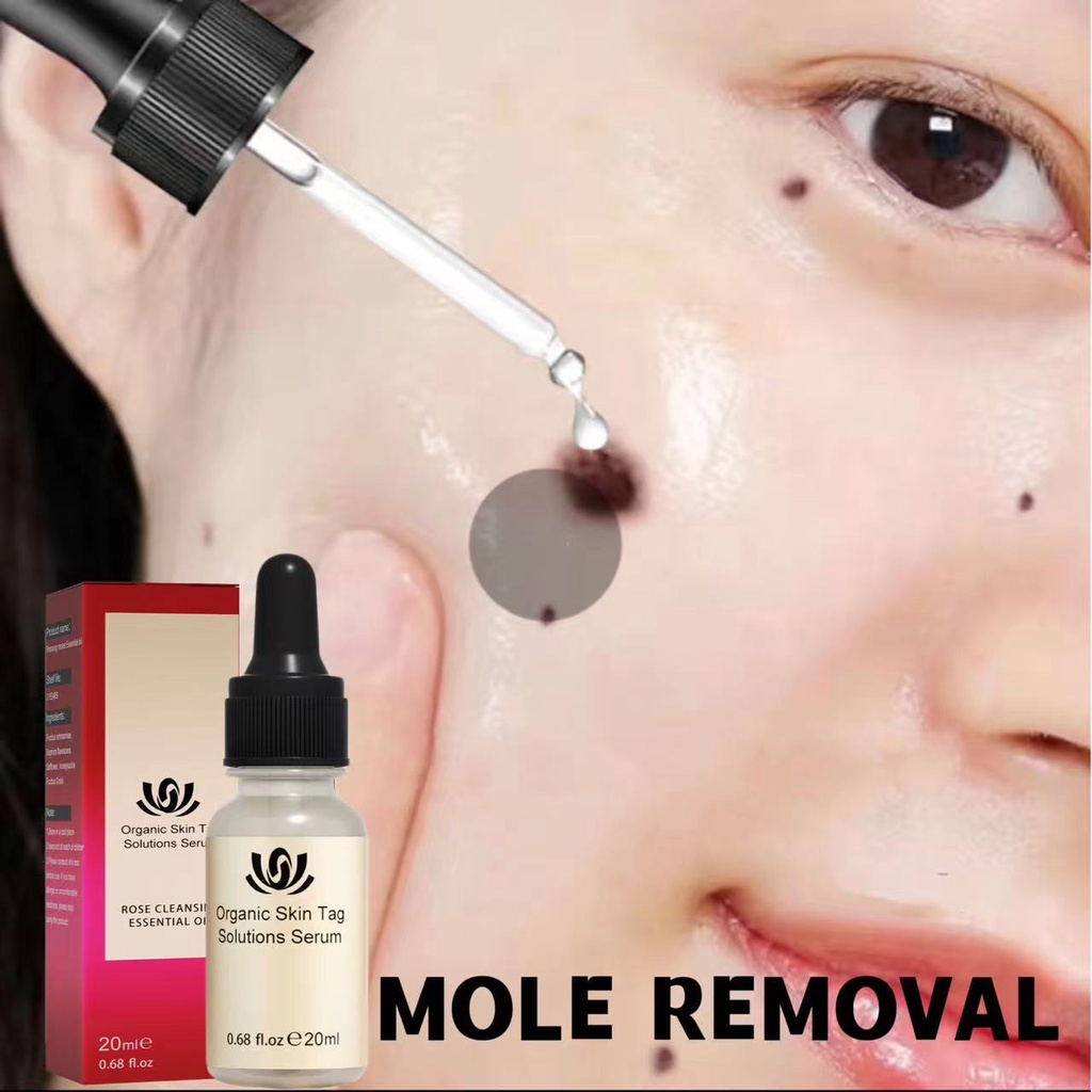 Jual 【EELHOE】Wart Removal Serum Penghilang Tahi Lalat Penghilang Kutil ...