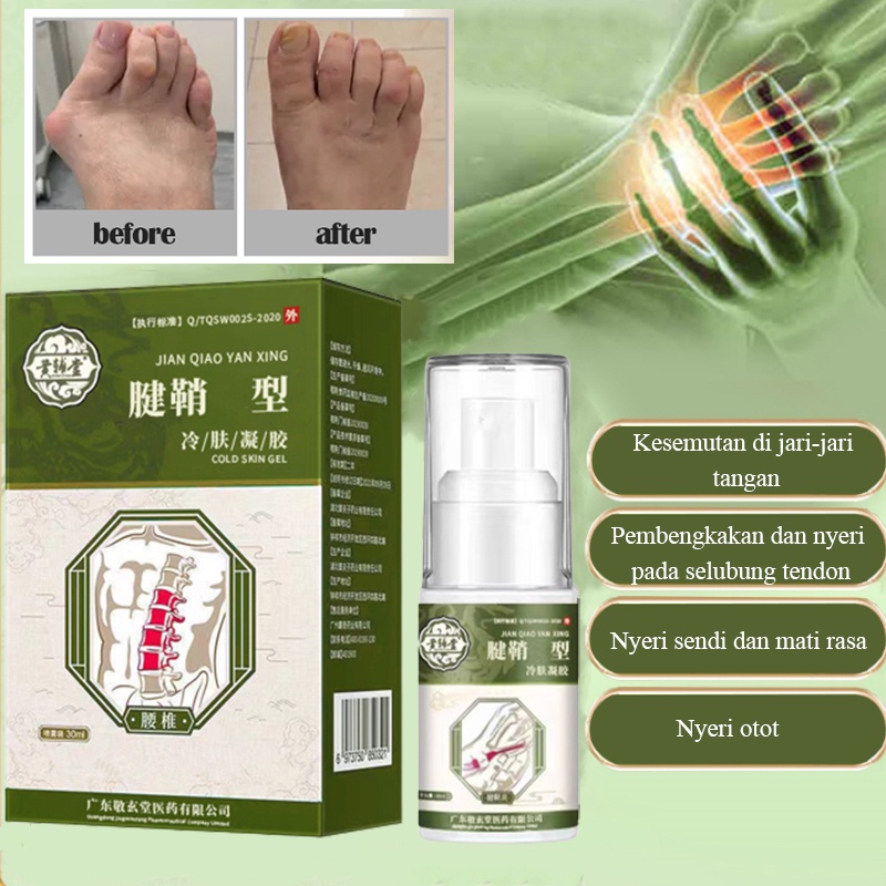 Jual APGAR Obat Tenosinovitis Spray Obat Tulang Dan Sendi Kompres ...