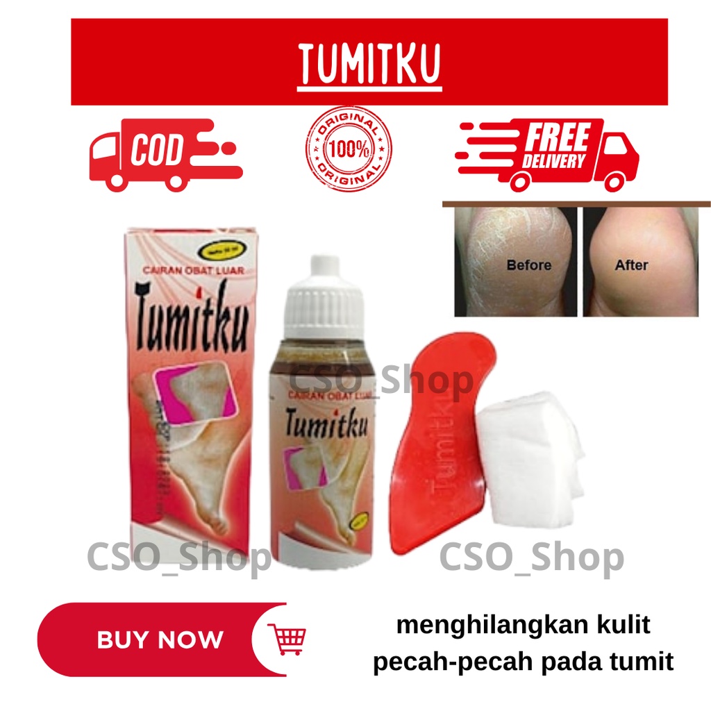 Jual TUMITKU MENGATASI KAKI PECAH/KAPALAN DENGAN INSTAN, BPOM | Shopee ...