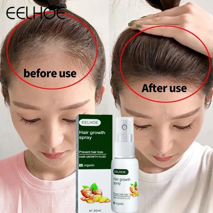 Jual EELHOE Ginger Germinal Spray Perawatan Rambut Rontok Hair Growth ...