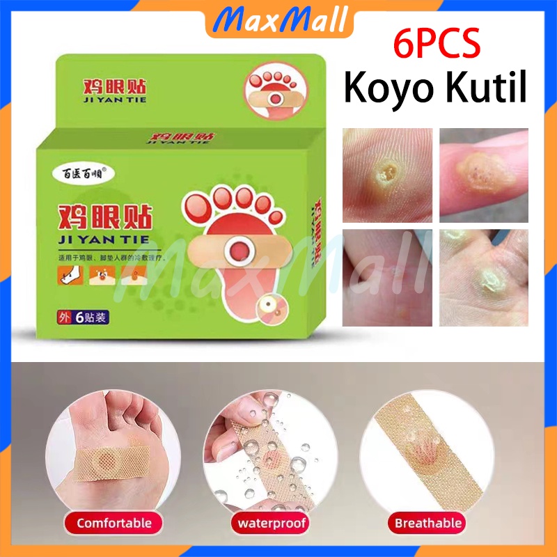 Jual 6PCS Plaster Kutil Set Plester Mata Ikan Foot Corn Removal Penutup ...