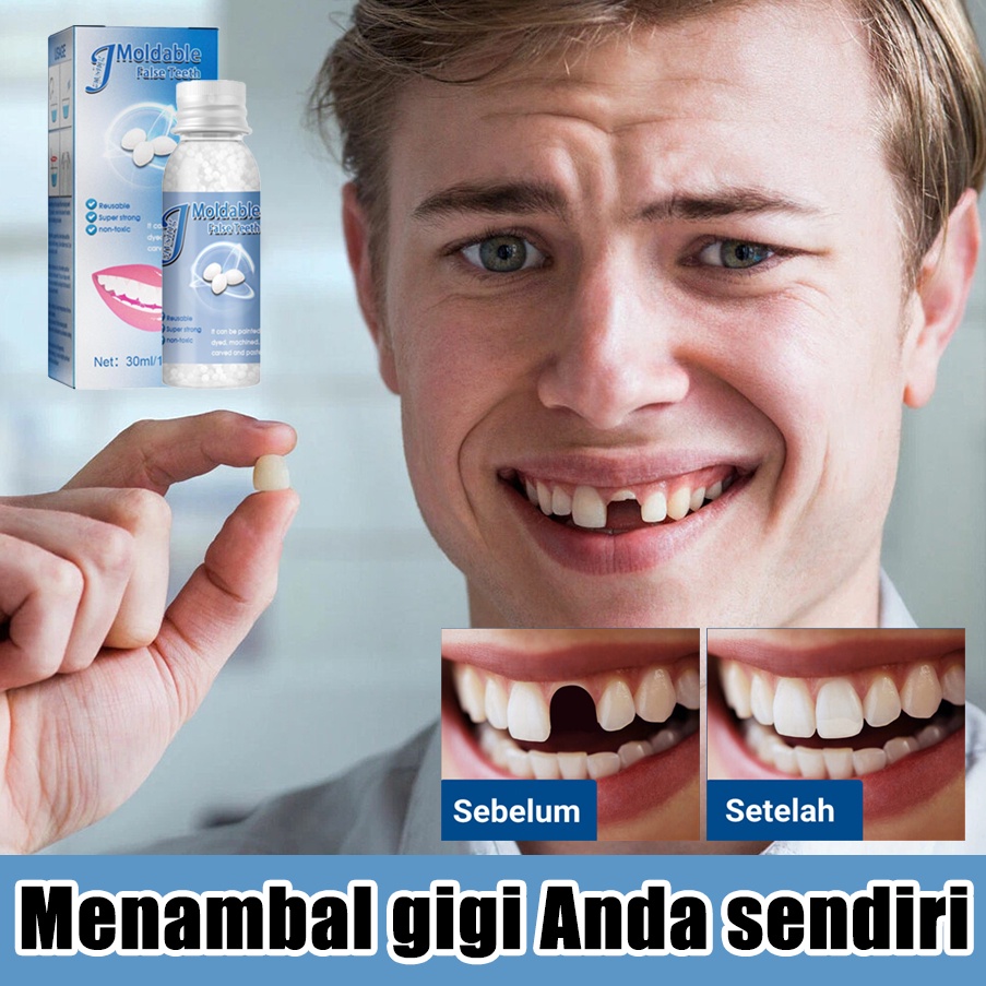 Jual Gigi palsu Penambal gigi Palsu Gigi Temporary Butir Penambal Gigi ...